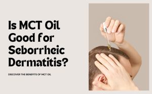MCT Oil For Seborrheic Dermatitis: Benefits & Usage